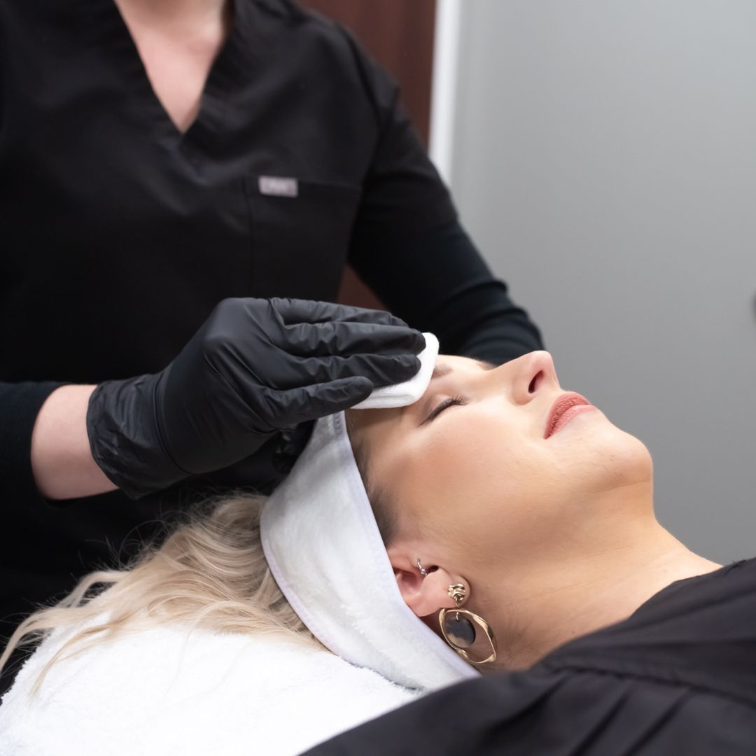 Chemical Peels | Medical Grade Quality Skin Peels